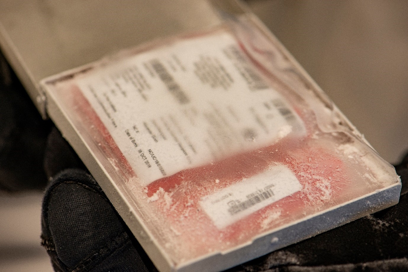 Stem cell storage: Invest in your family’s future health Stem cell ...