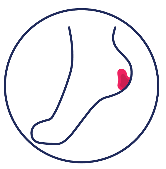 AmnioRederm | Biological Wound Dressing | Soft Tissue Wounds