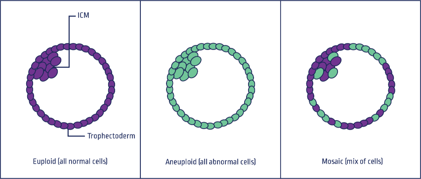 PGT-A - Preimplantation Genetic Testing for Aneuploidies